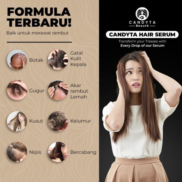 candyta – atasi masalah rambut gugur